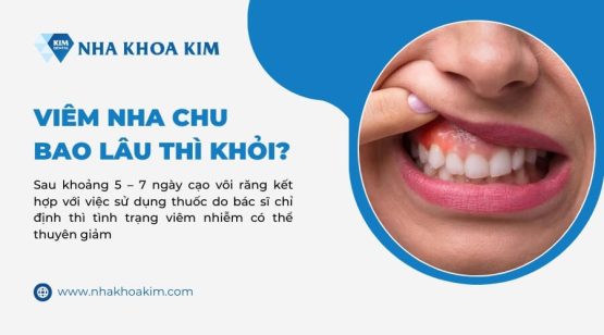 Viêm nha chu là gì? Nguyên nhân và cách điều trị