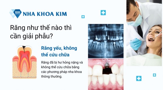 Giải phẫu răng là gì? Răng như thế nào thì cần giải phẫu?