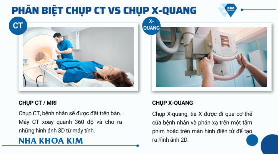 Chụp CT là gì? Phân biệt với công nghệ chụp X-quang hiện nay