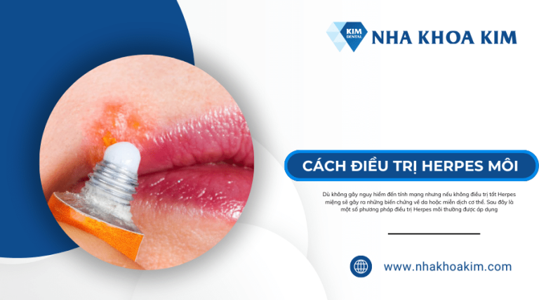 Herpes là gì? Cách nhận biết và điều trị herpes môi