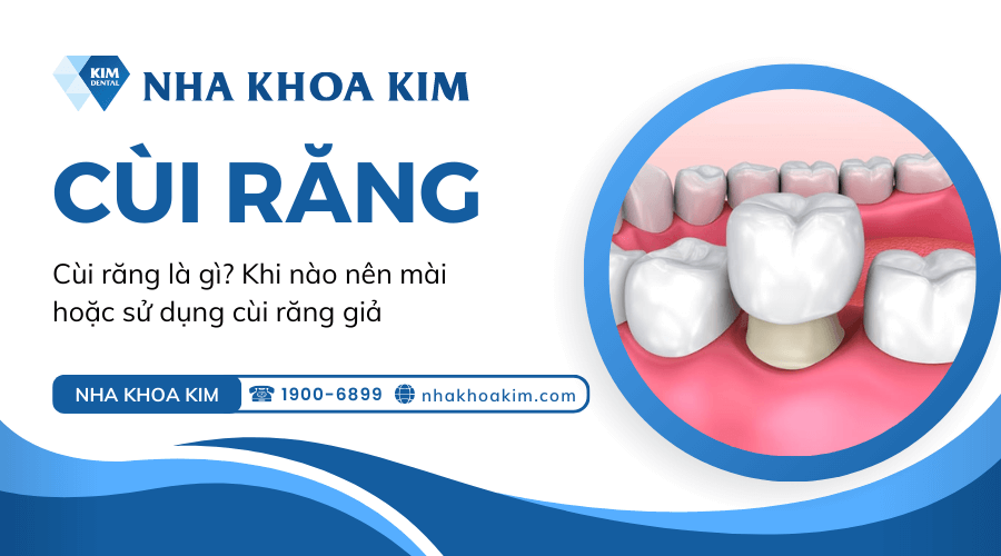 Cùi răng là gì? Khi nào nên mài hoặc sử dụng cùi răng giả - Nha Khoa ...