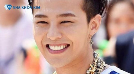 Hàm răng đẹp chuẩn Y khoa là như thế nào? Tiêu chí đánh giá