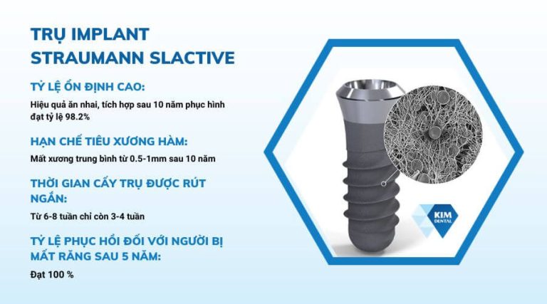 Trụ Implant Straumann Thụy Sỹ: Xuất xứ, ưu điểm và giá cả