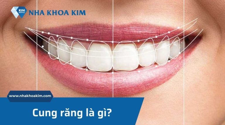 Cung răng là gì? Cách đọc và quan sát cung răng