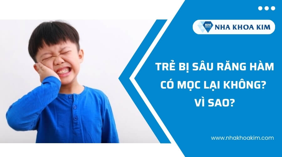 Trẻ Bị Sâu Răng Hàm Có Mọc Lại Không? Vì Sao?