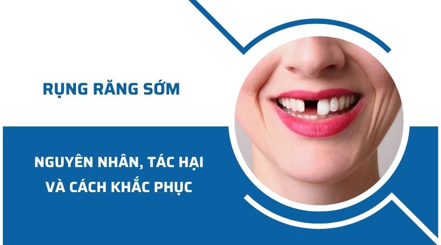 Rụng răng sớm: Nguyên nhân, tác hại và cách khắc phục
